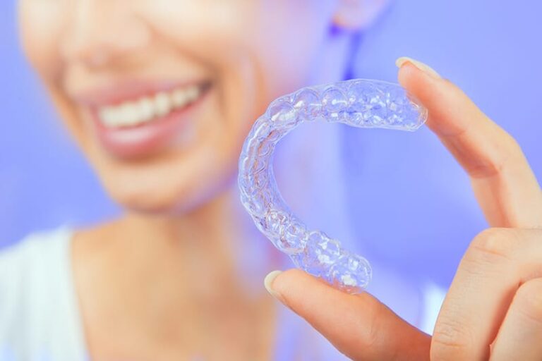 Your Guide to At-Home Teeth Whitening | Springs Dental